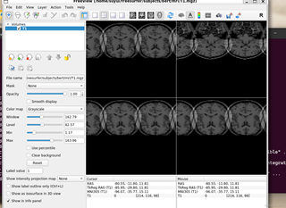 关于freesurfer使用freeview可视化的问题_服务器-CSDN问答